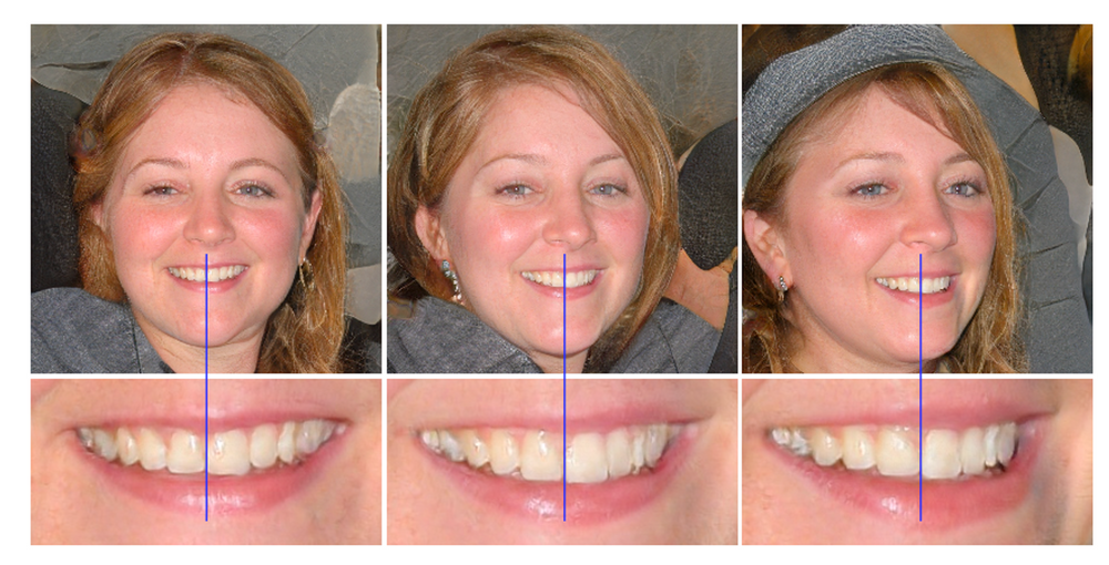 The Evolution of StyleGAN: Introduction